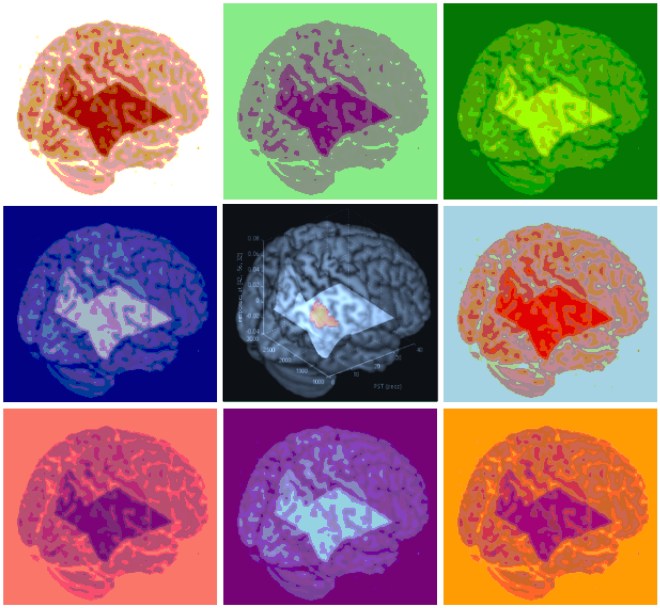 Neuroconservation, the brain on fire – Fire up Water down